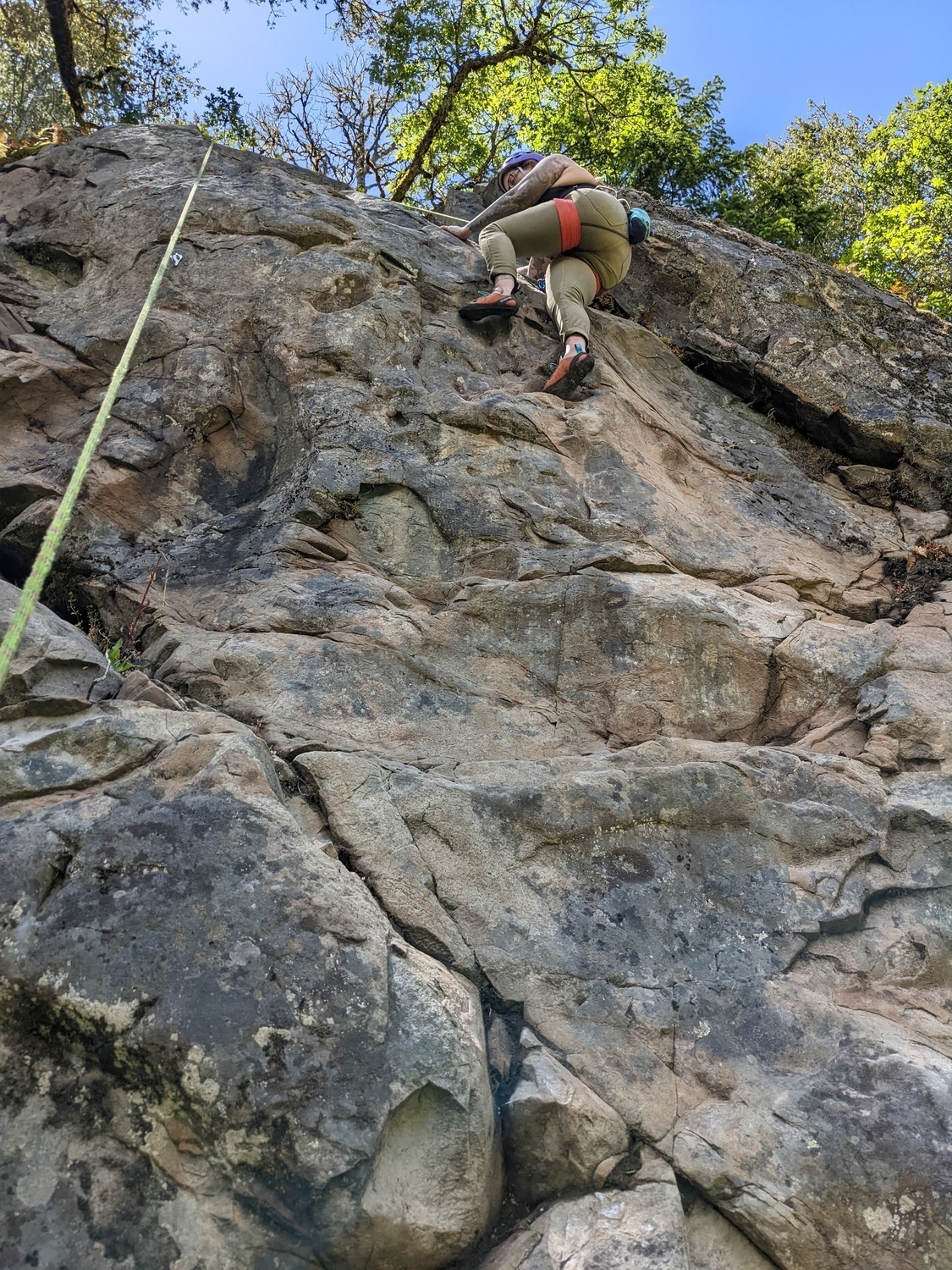 Femur follows the rope, Spiral Fracture offers several options to the ...